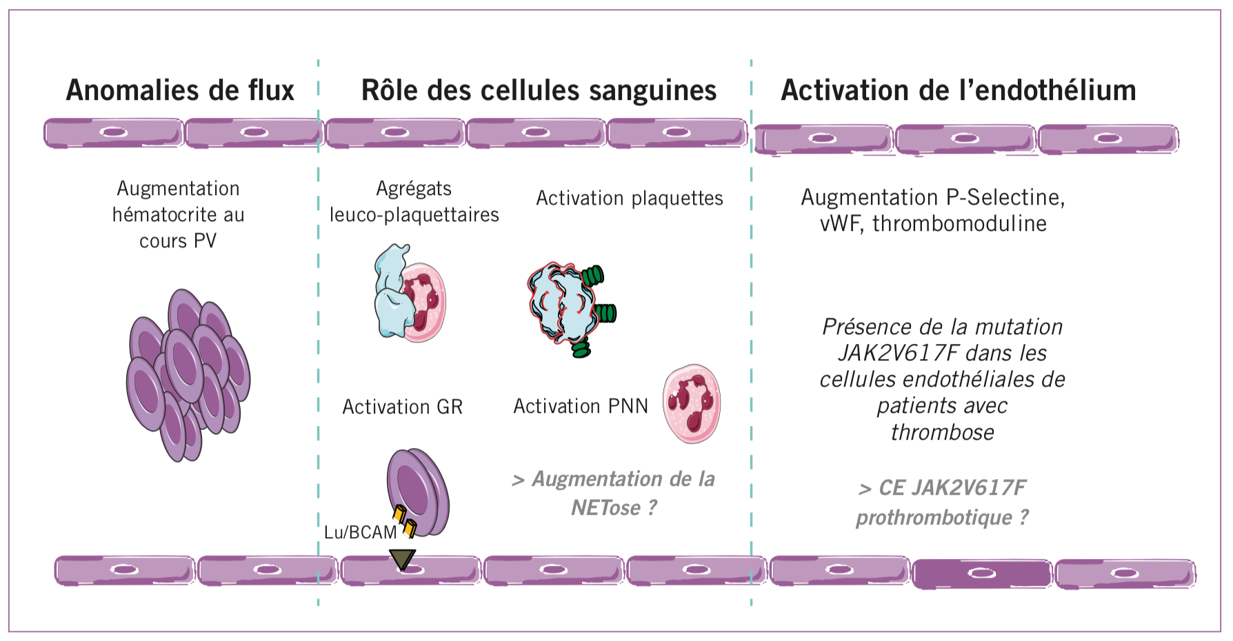 Thromboses et Hémopathies - Horizons Hémato